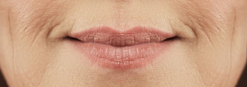 Lip Wrinkles: Causes, Preventions and Treatments - Ask The Experts